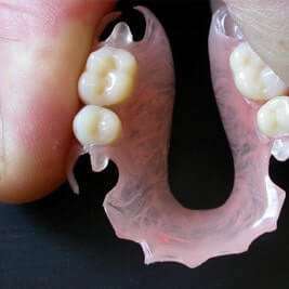 Prótese flexível - Consulta Ideal